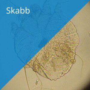 Bilder - Skabbguiden